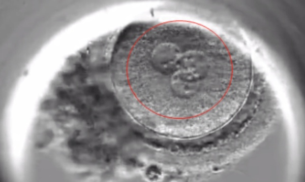 不了解试管婴儿2pn与2pb是什来看，哪个好全囊括 - 相因网