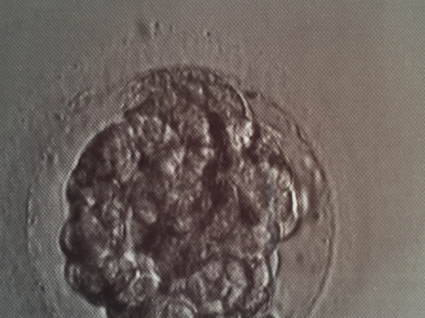 胚胎3ab是什么意思、男孩还是女孩剖析，试管夫妻必知 - 相因网