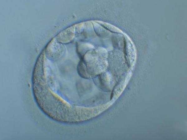 不了解5aa胚胎怎么样、生男生女来看，和4bb哪个好一篇汇总 - 相因网